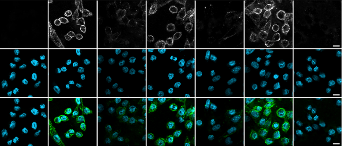 Confocal Imaging